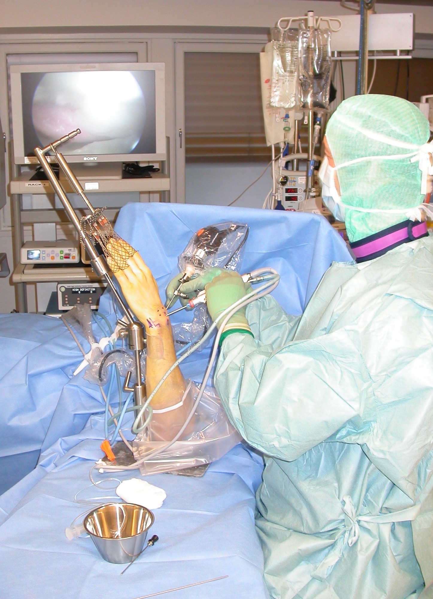 Håndleddsartroskopi - Kirurgen